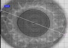 How to Measure HVID