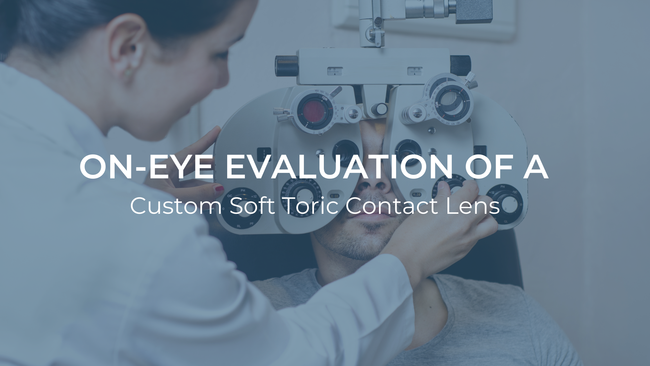 On-Eye Evaluation of a Custom Soft Toric Contact Lens