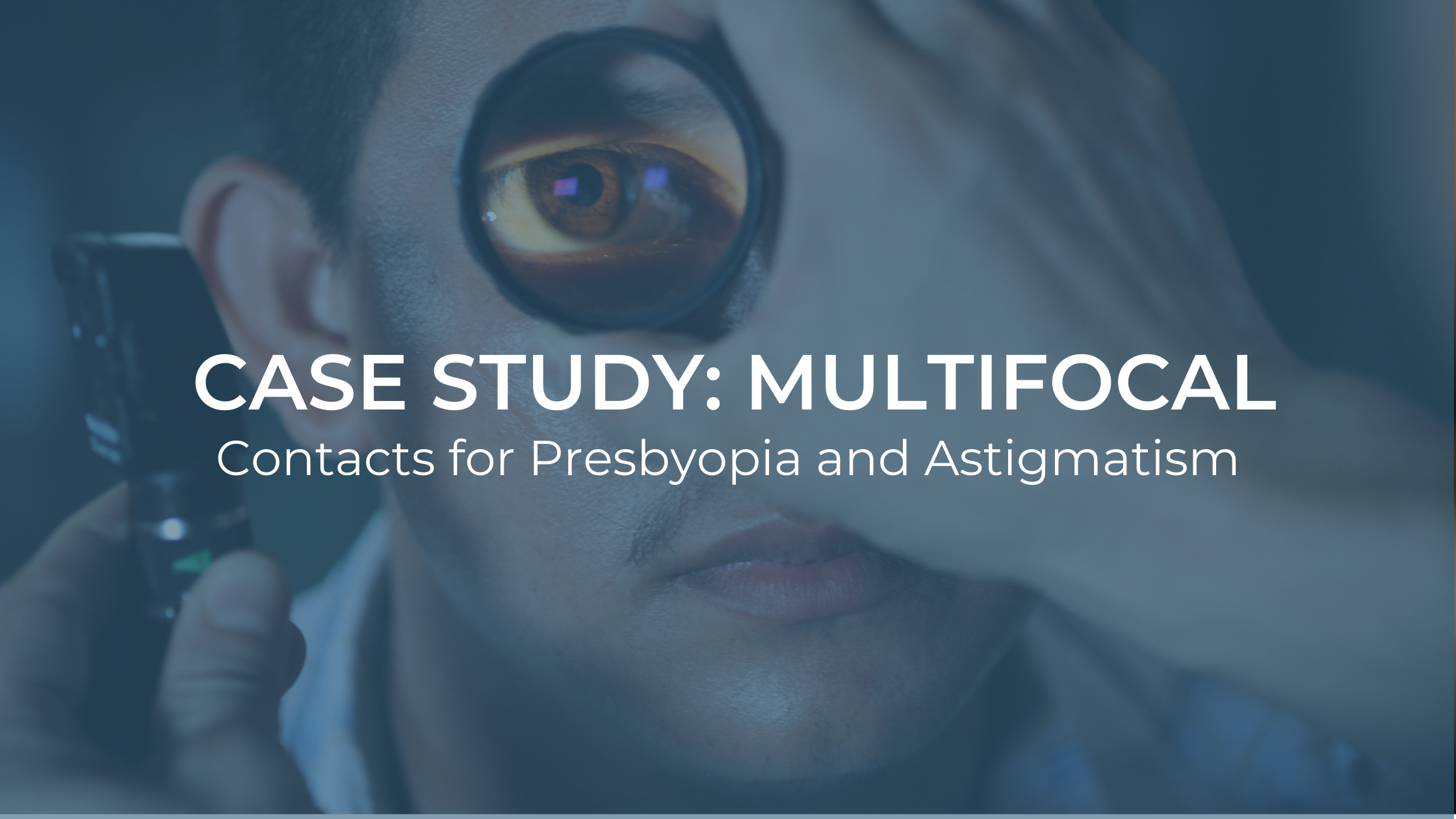 Case Study: Multifocal Contacts for Presbyopia and Astigmatism