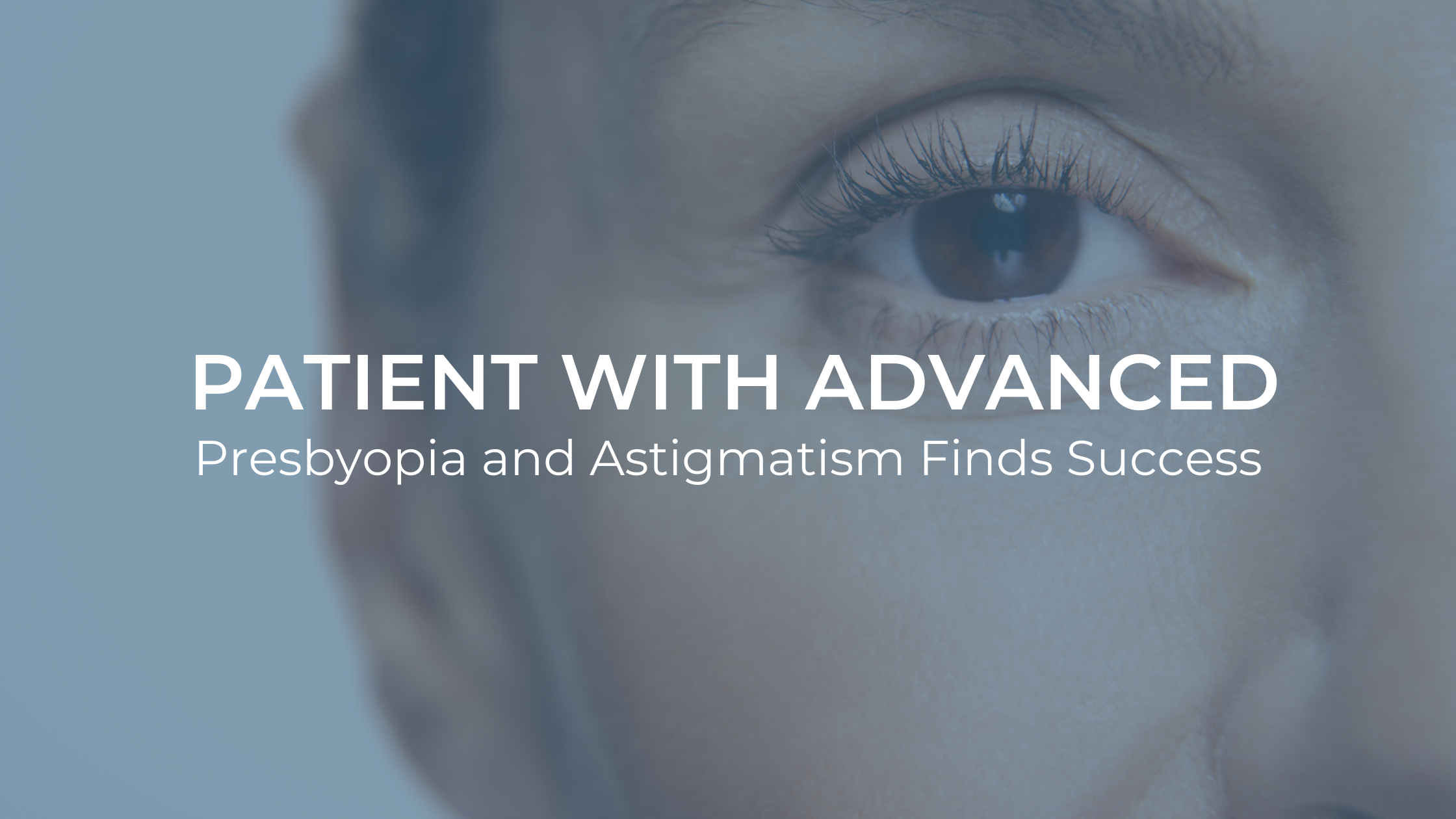 Patient with Advanced Presbyopia and Astigmatism Finds Success