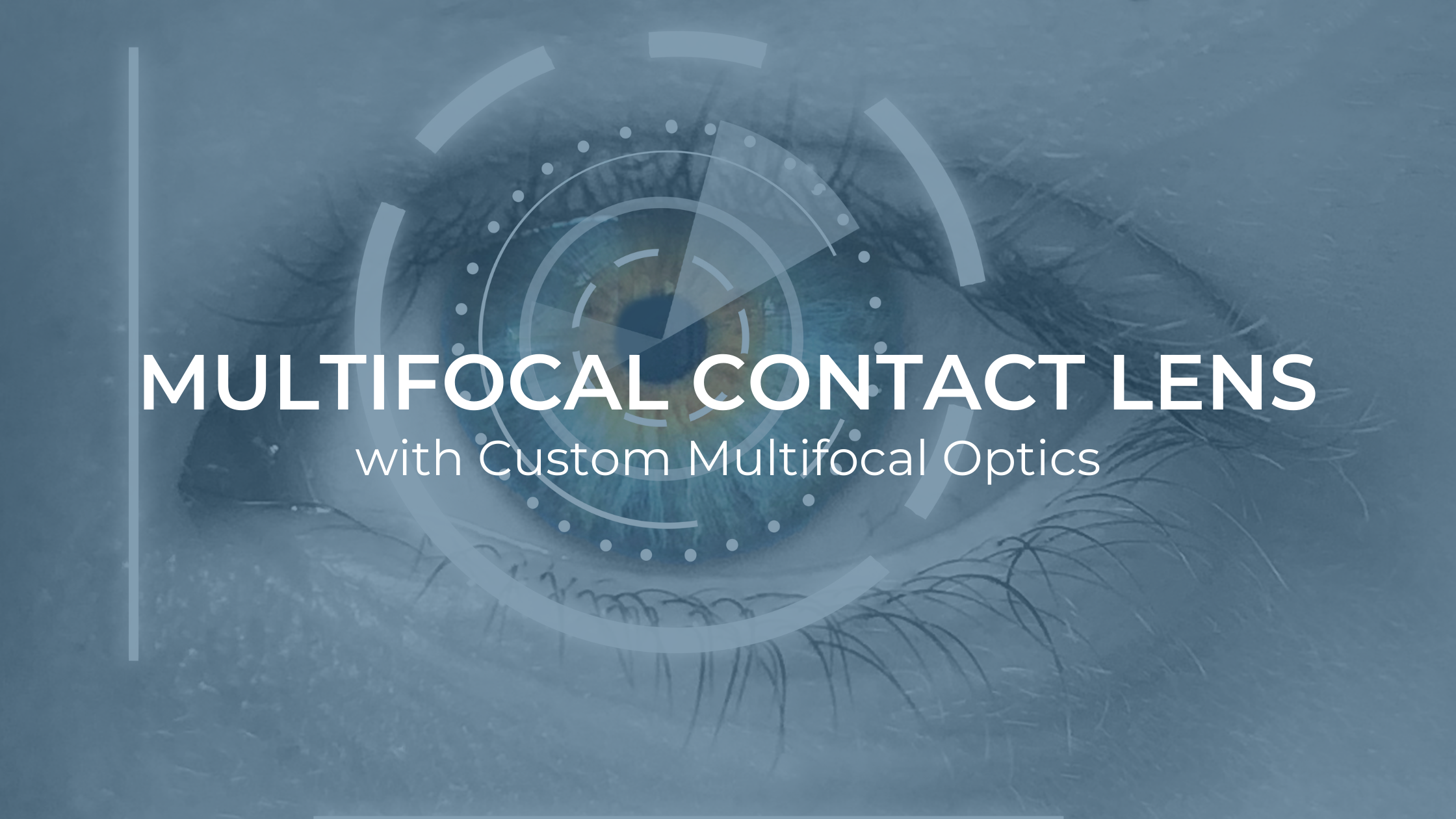 Multifocal Contact Lenses with Custom Multifocal Optics